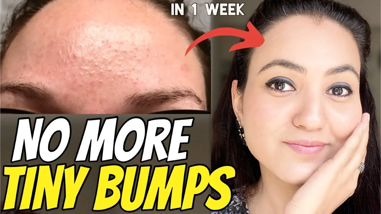 7 days challenge to get rid of tiny bumps on face