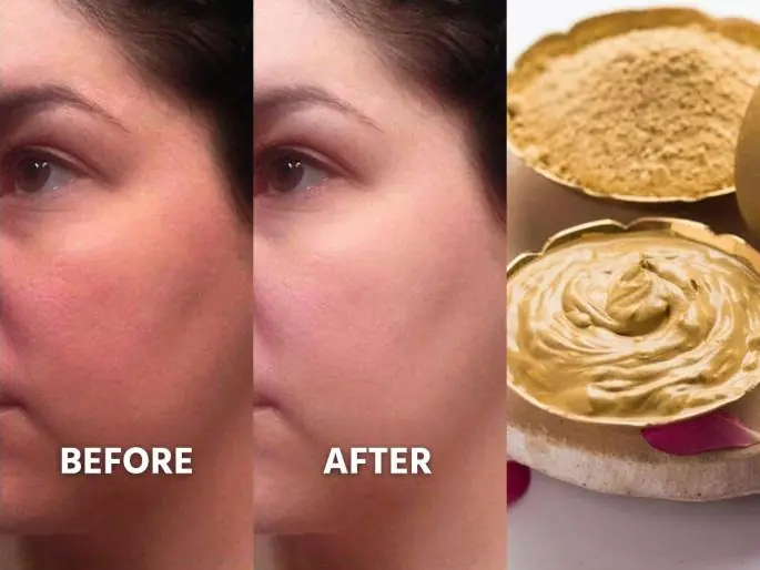 Gram Flour And Fuller’s Earth Everyday Face Wash To Get Clear Skin
