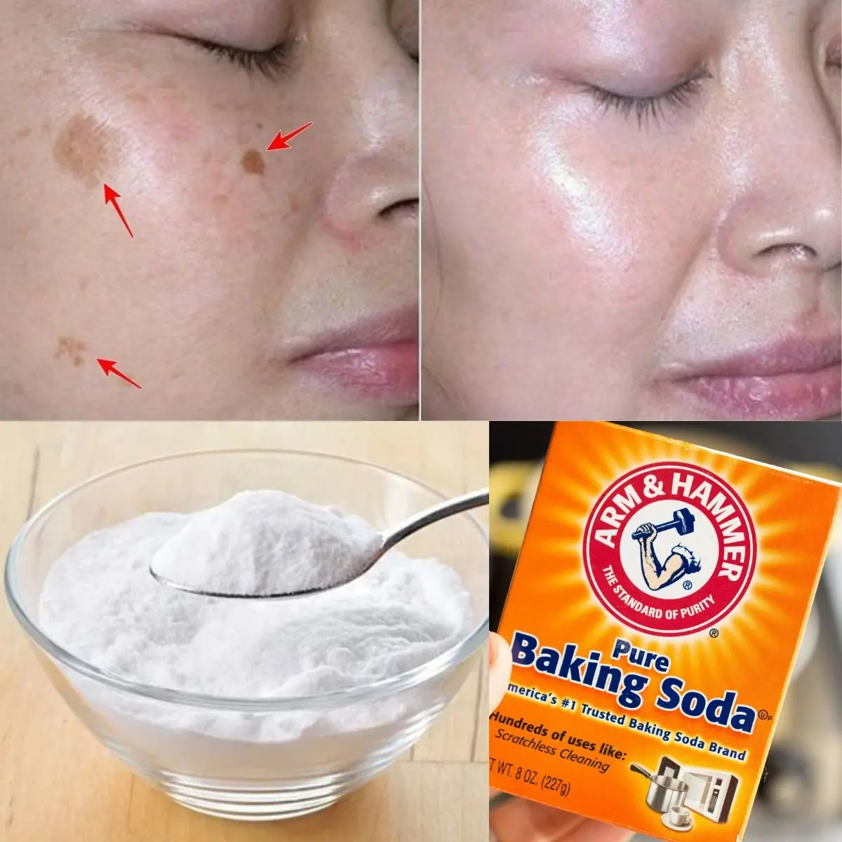 4 Ways To Erase Age Spots with Baking Soda for Spotless Even Skin