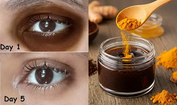 6 Homemade Coffee Eye Masks to Get Rid of Dark Circles | Under Eye ...
