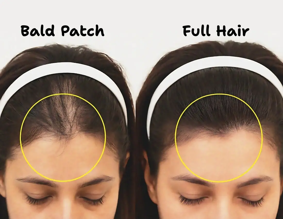 Easy DIY the Magic of Fenugreek Oil at Home for Healthier, Fuller Hair